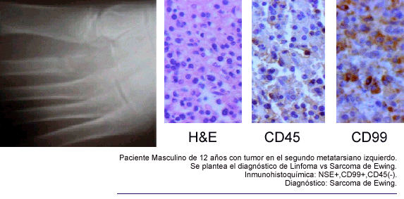 Vitae10-Anatomía Patológica